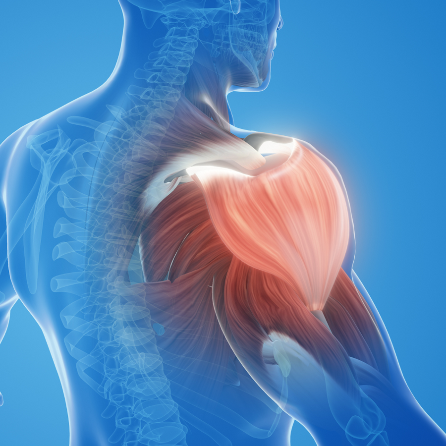 Shoulder Impingement – Zlaant